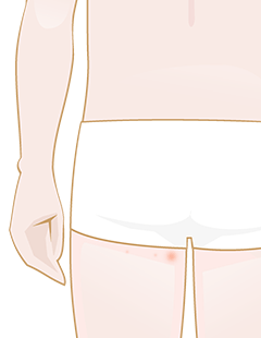 Wie wird man Pickel am Po los? » 4 effektive Tipps